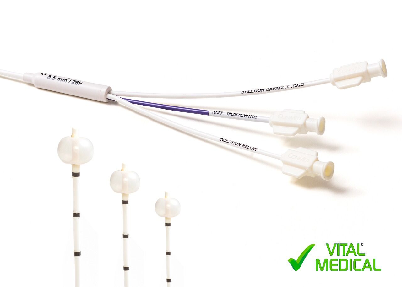 Balão Extrator de Cálculos - Duraglide – BW Medical